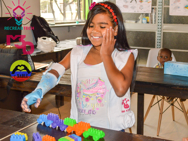Art Meets 3D Printed Assistive e-NABLE Devices! – Enabling The Future Art Meets 3D Printed Assistive e-NABLE Devices! – Enabling The Future