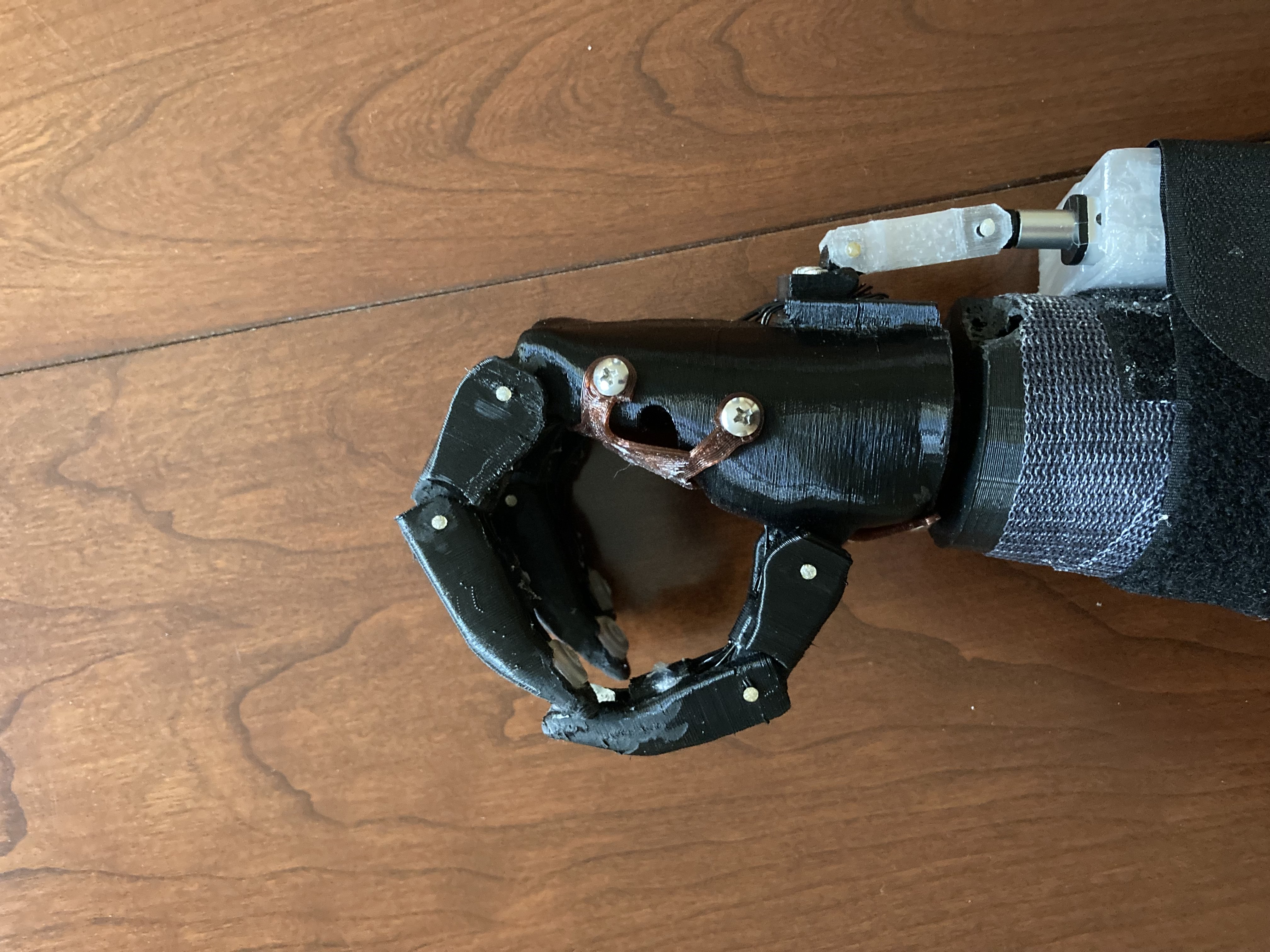 Survivors of Traumatic Injury Are Leading an Open Source Revolution in ...